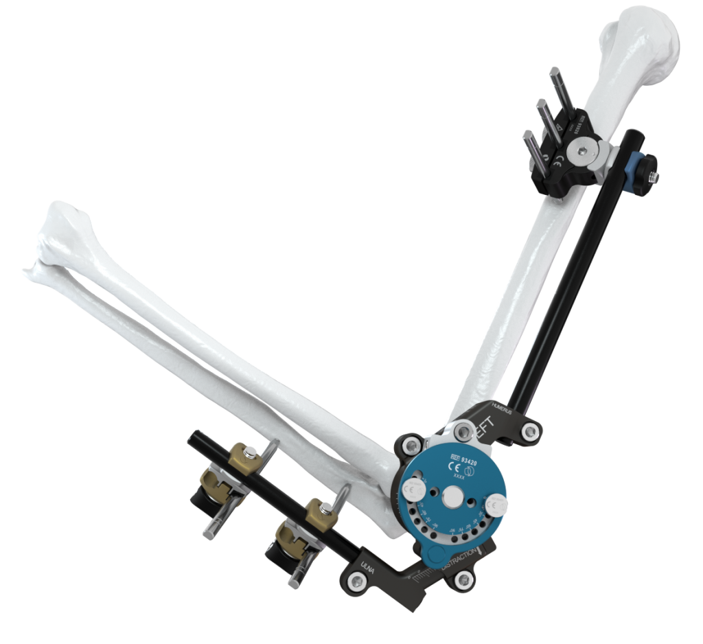 External Fixator Joint Components | Orthofix Galaxy Fixation™