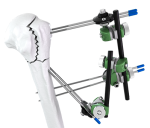 External Fixator Joint Components | Orthofix Galaxy Fixation™